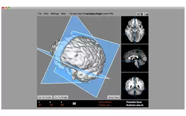 Dicom Medical Image Viewerin Chrome with by